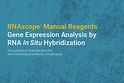 A Lunch and Learn Seminar Road-Trip in Finland: Exploring the RNAscope ...